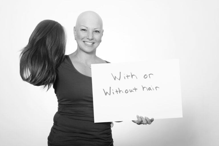 Newly Diagnosed - National Alopecia Areata Foundation | NAAF