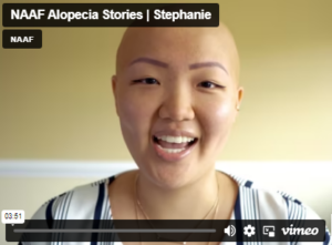 Alopecia Areata Patient Voice - Stephanie - National Alopecia Areata ...