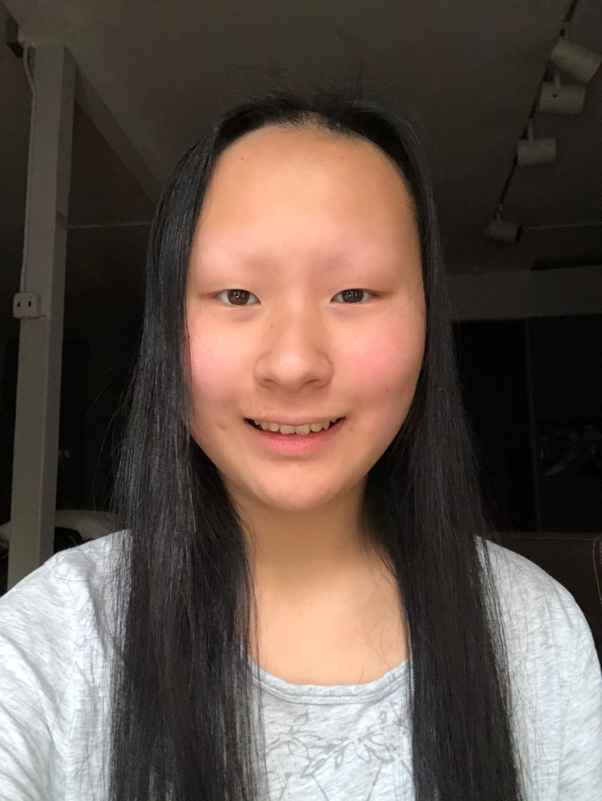 Youth Mentors - National Alopecia Areata Foundation | NAAF