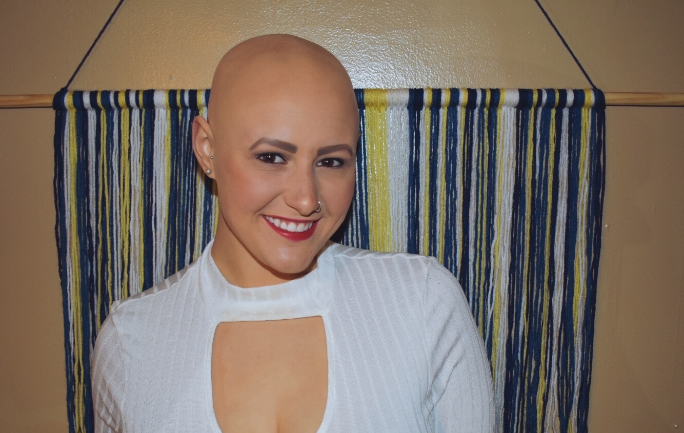 Youth Mentors - Page 2 of 16 - National Alopecia Areata Foundation | NAAF