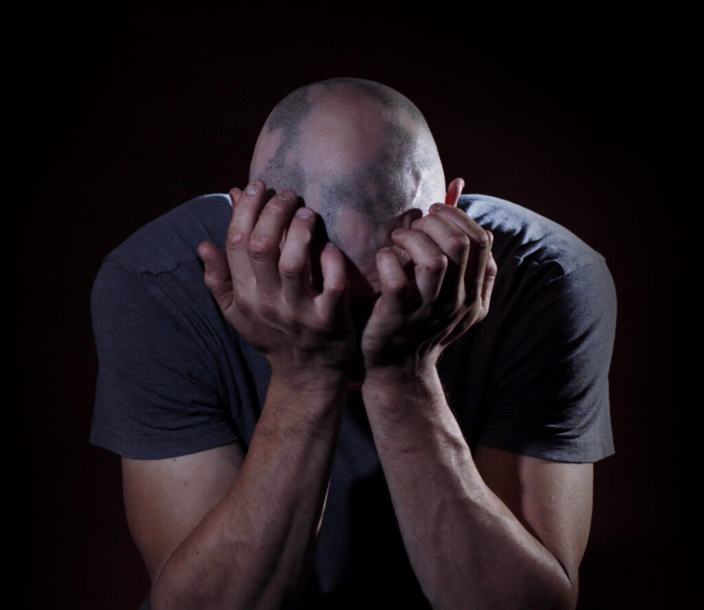 Related Conditions - National Alopecia Areata Foundation | NAAF
