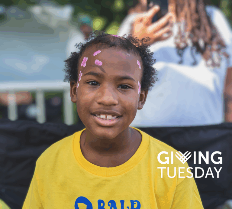 Home - National Alopecia Areata Foundation | NAAF